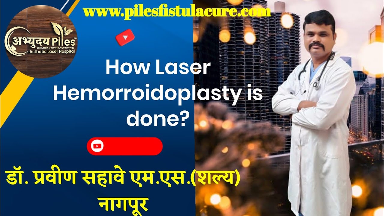 How Laser hemorrhoidoplasty (LHP) done for Hemorrhoids(Piles )? - YouTube