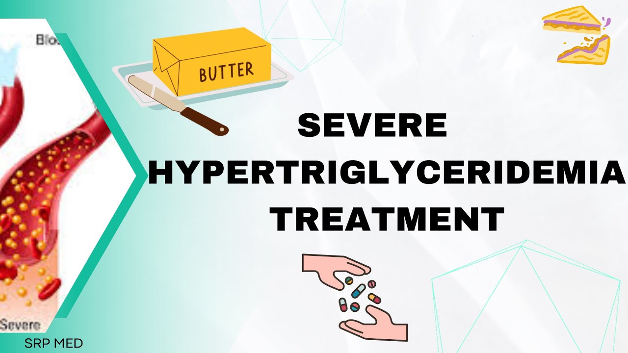 Severe Hypertriglyceridemia/Treatment/Fibrates/Omega 3 FA - YouTube