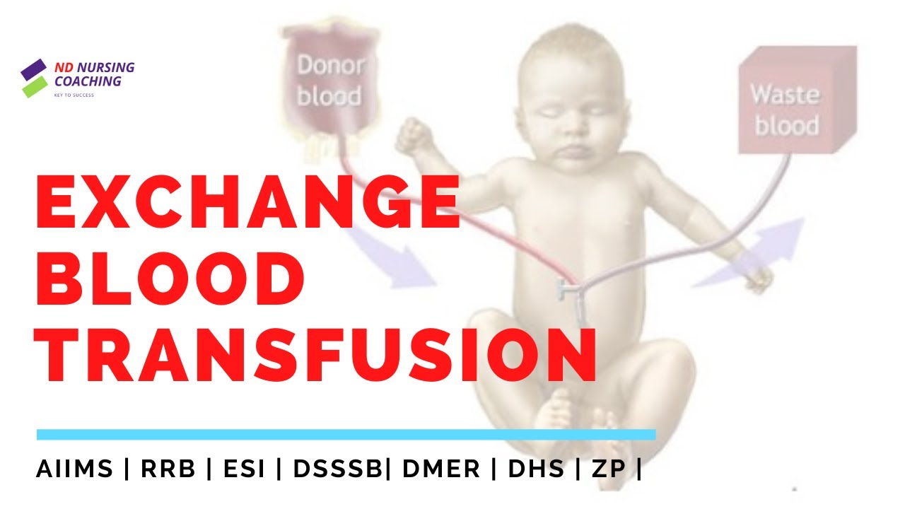 Neonatal Jaundice Exchange Transfusion