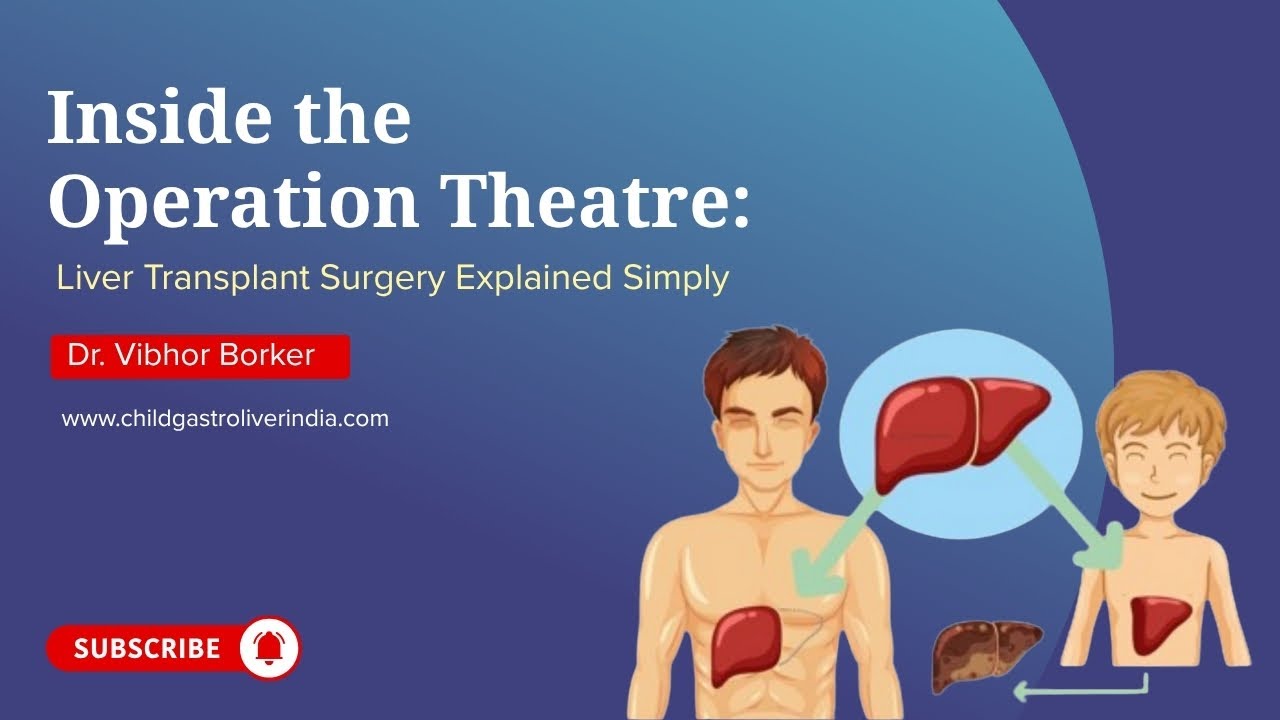 Inside the Operation Theater: Liver Transplant Surgery Explained Simply ...