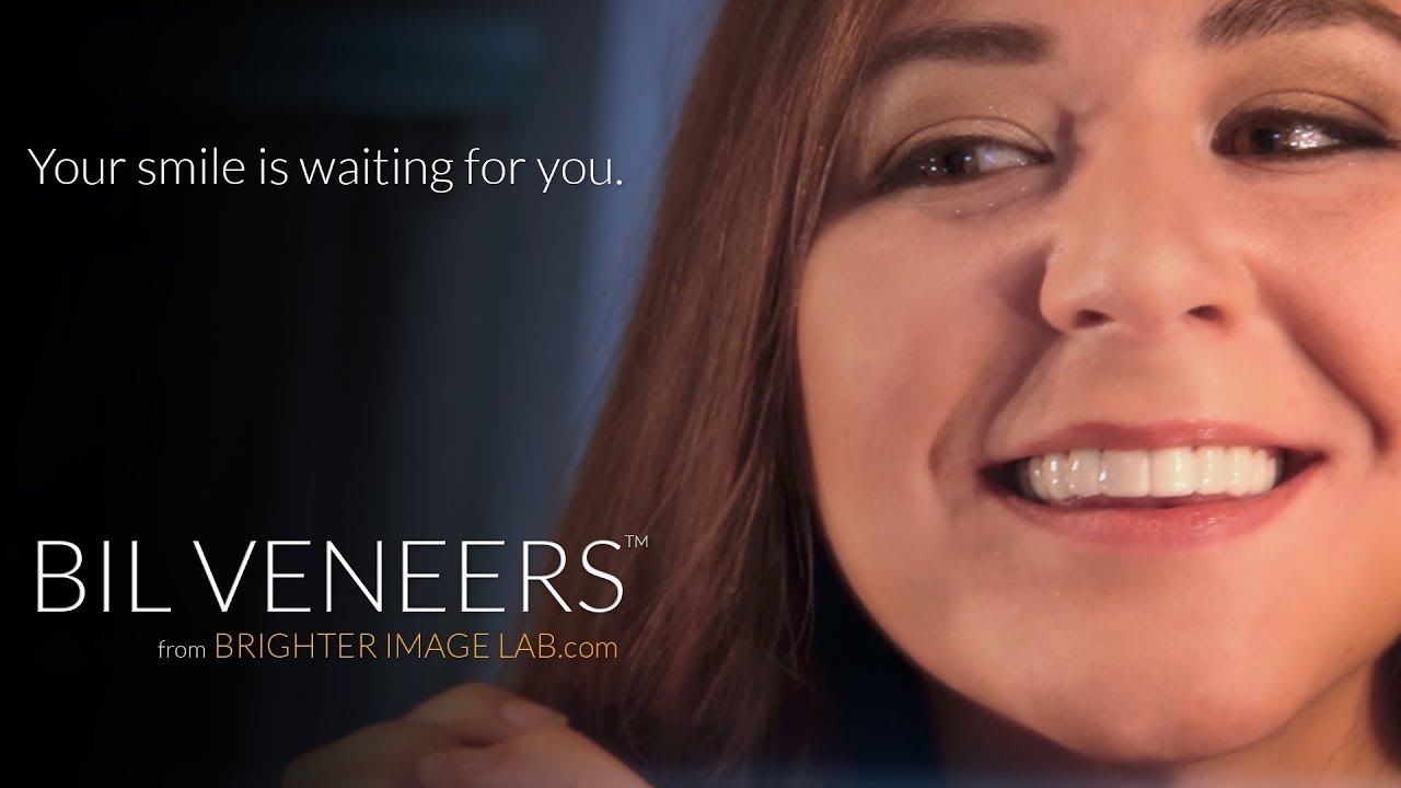 2017 Bilveneers TV Commercial $149 dn for Chipped, Broken or Crooked ...