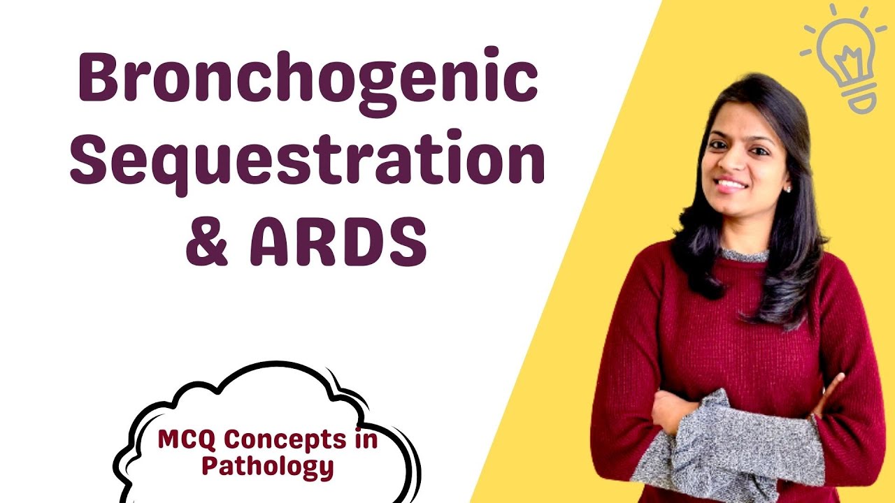 Bronchogenic Sequestration & Acute Respiratory Distress Syndrome (ARDS ...