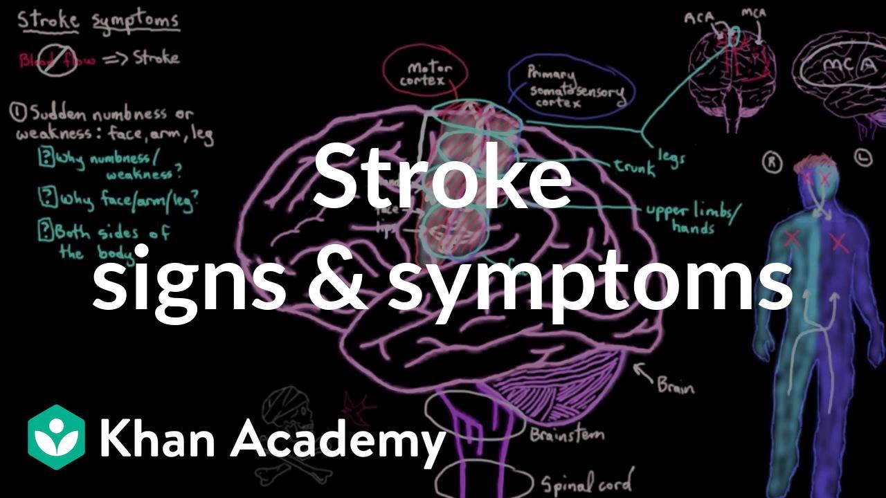 Common stroke signs and symptoms | Circulatory System and Disease ...