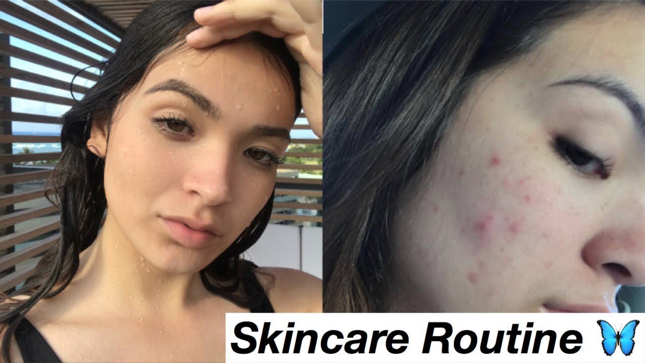 My Skincare Routine How I Cleared My Skin Fast Youtube