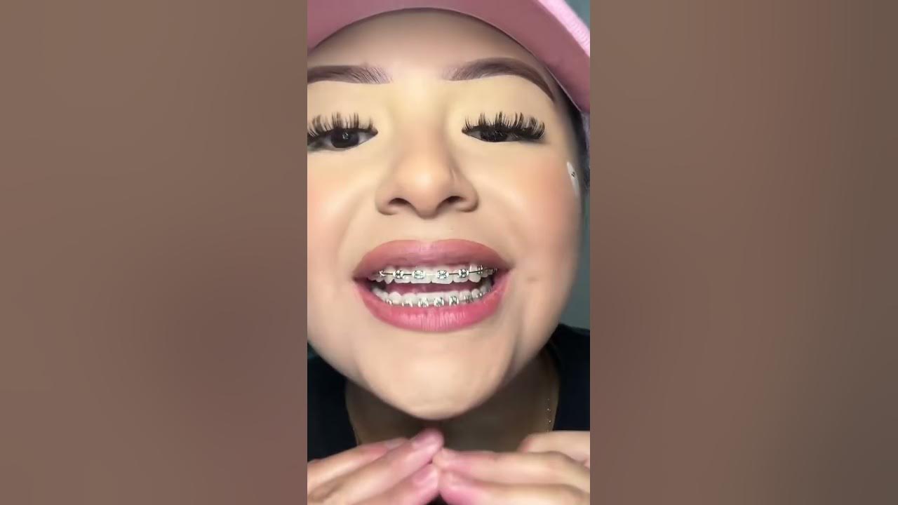 Matching my braces with my outfit 💕🫶🏼 #bracescolors #braces # ...