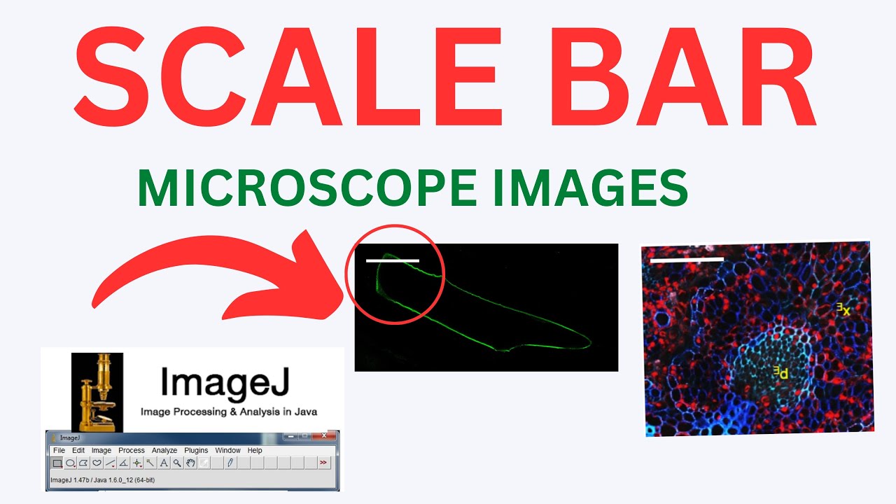 Adding A Scale Bar To Microscopic Images By Image J Software YouTube adding-a-scale-bar-to-microscopic-images-by-image-j-software-youtube