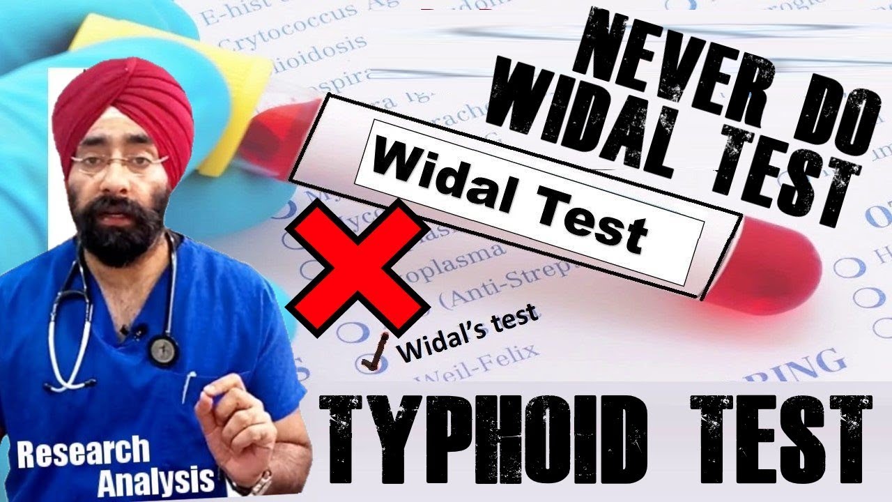 How to Diagnose Typhoid Fever | Never do Widal test | Dr.Education (Eng ...