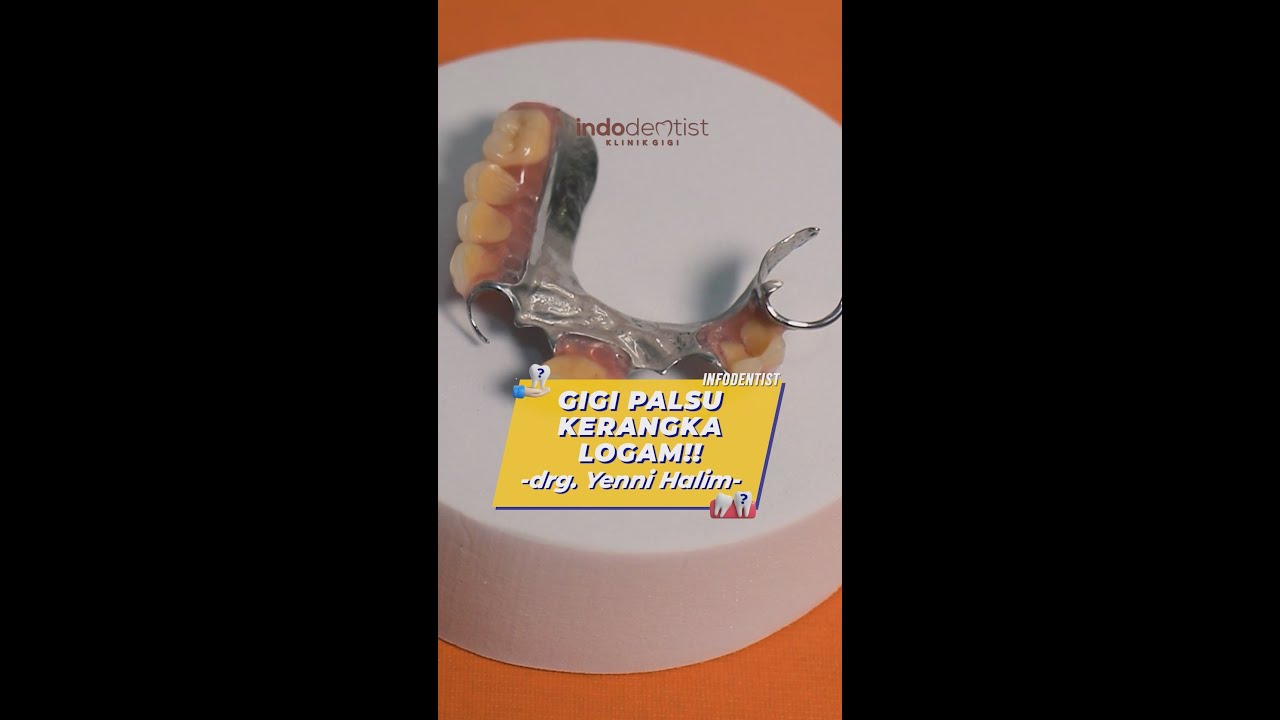 GIGI PALSU KERANGKA LOGAM (FRAME DENTURE) - YouTube