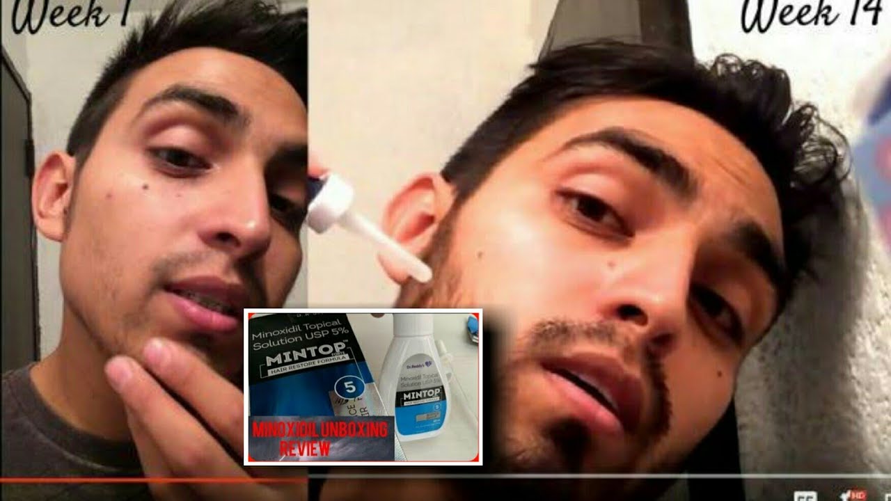 Real Beard Growth 2 Months Proof/ Minoxidil5℅ Mintop Dr.Reddy Buy ...