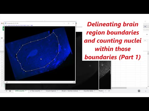 Delineating specific brain regions and counting nuclei with FIJI / ImageJ (Part 1)