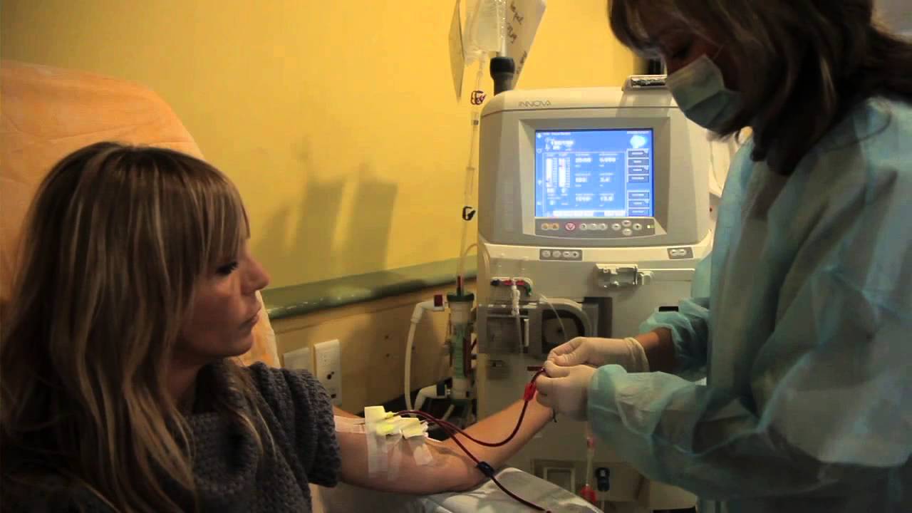 Fistule artério veineuse pour hémodialyse,Dr Jérome Sampol - YouTube