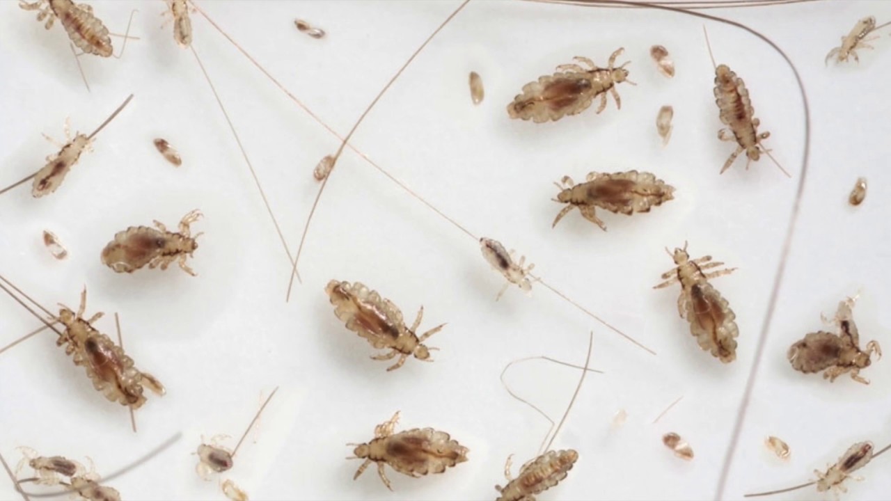 Pediculosis pùbica, ladillas como se me quitan - YouTube