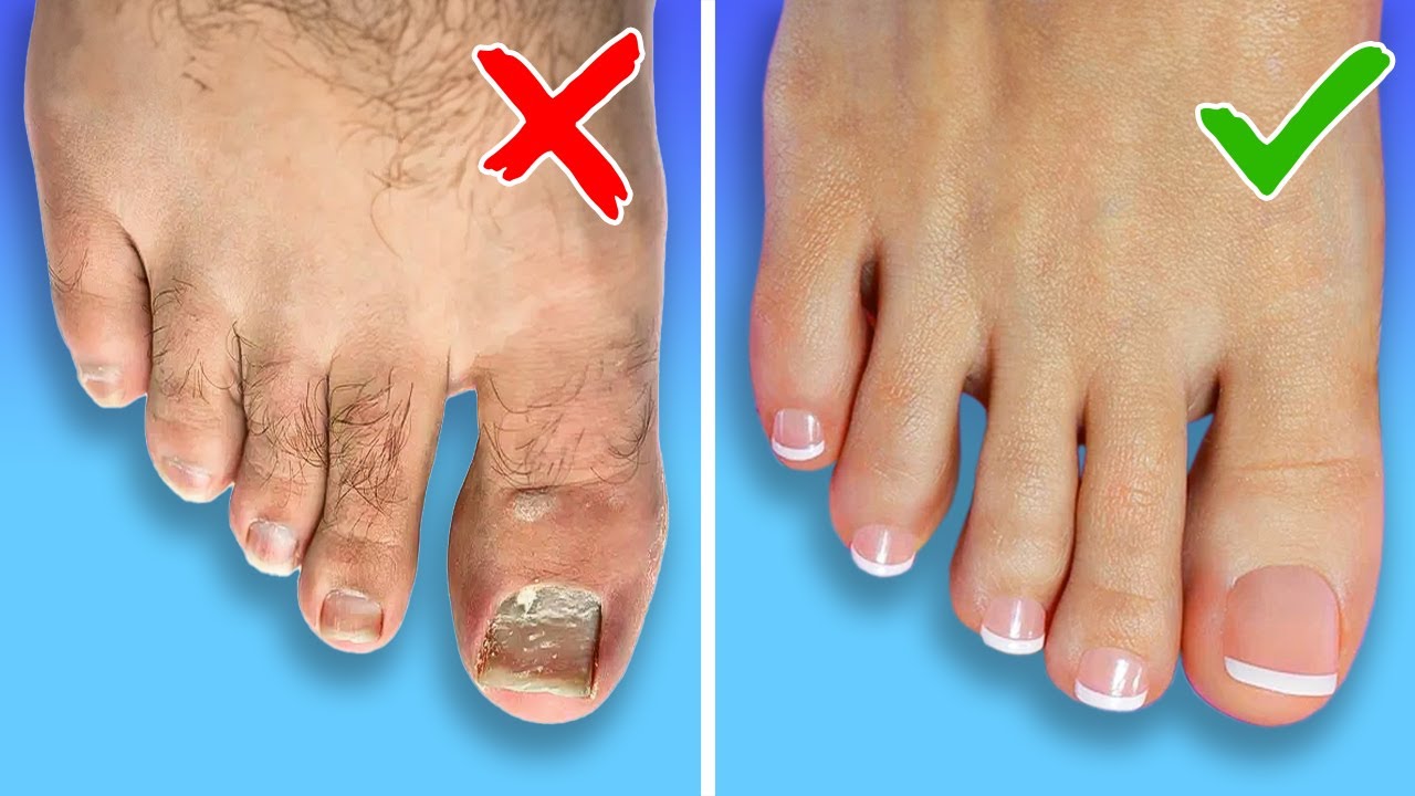 ULTIMATE AT HOME FOOT CARE! *Feet Transformation* - YouTube