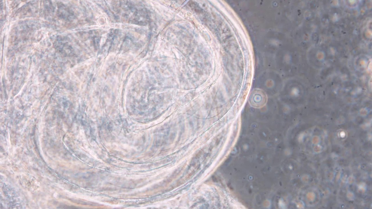 AF8M1 Seminal Receptacle - YouTube