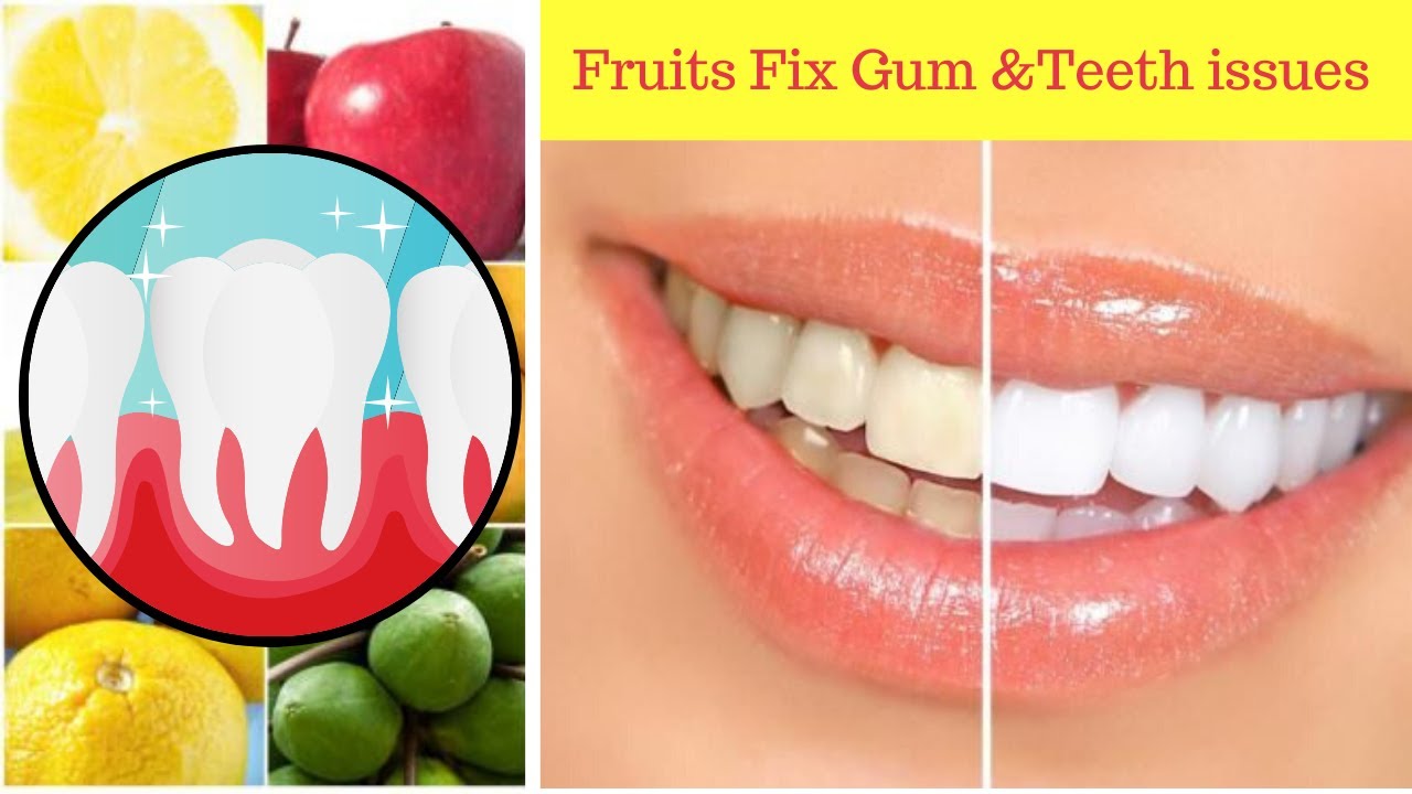 Best fruits can fix most of your gum and teeth issues at home - YouTube
