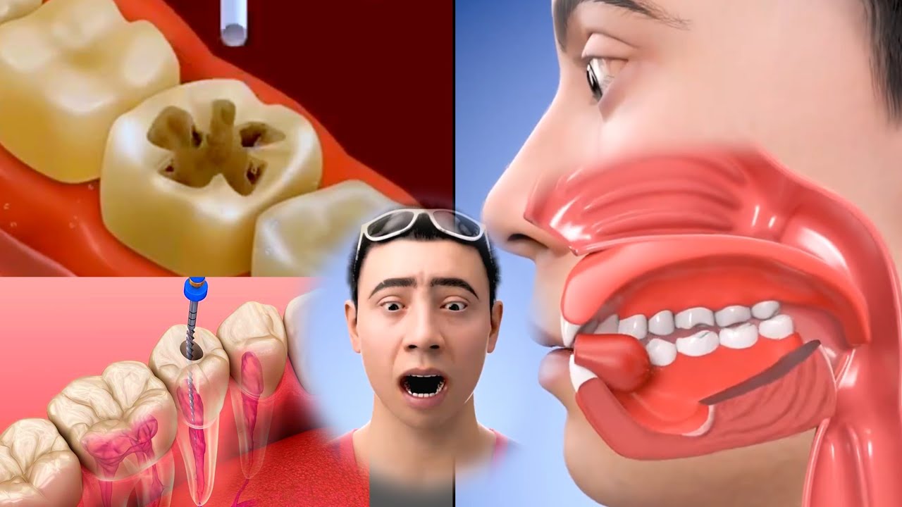 ASMR Satisfying Tooth & Cavity Treatment Animation | Teeth whitening ...