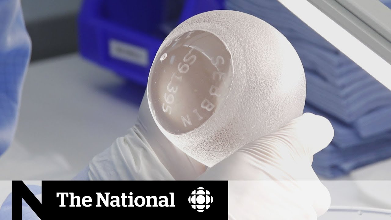 Canadian doctors sounding the alarm over Biocell breast implants | The ...