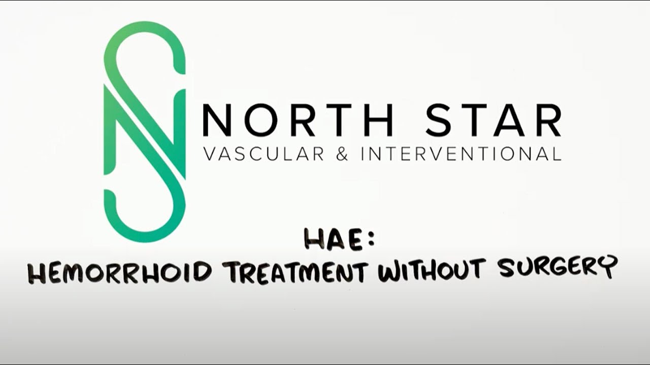 A non-surgical solution for hemorrhoids: Hemorrhoid Artery Embolization ...