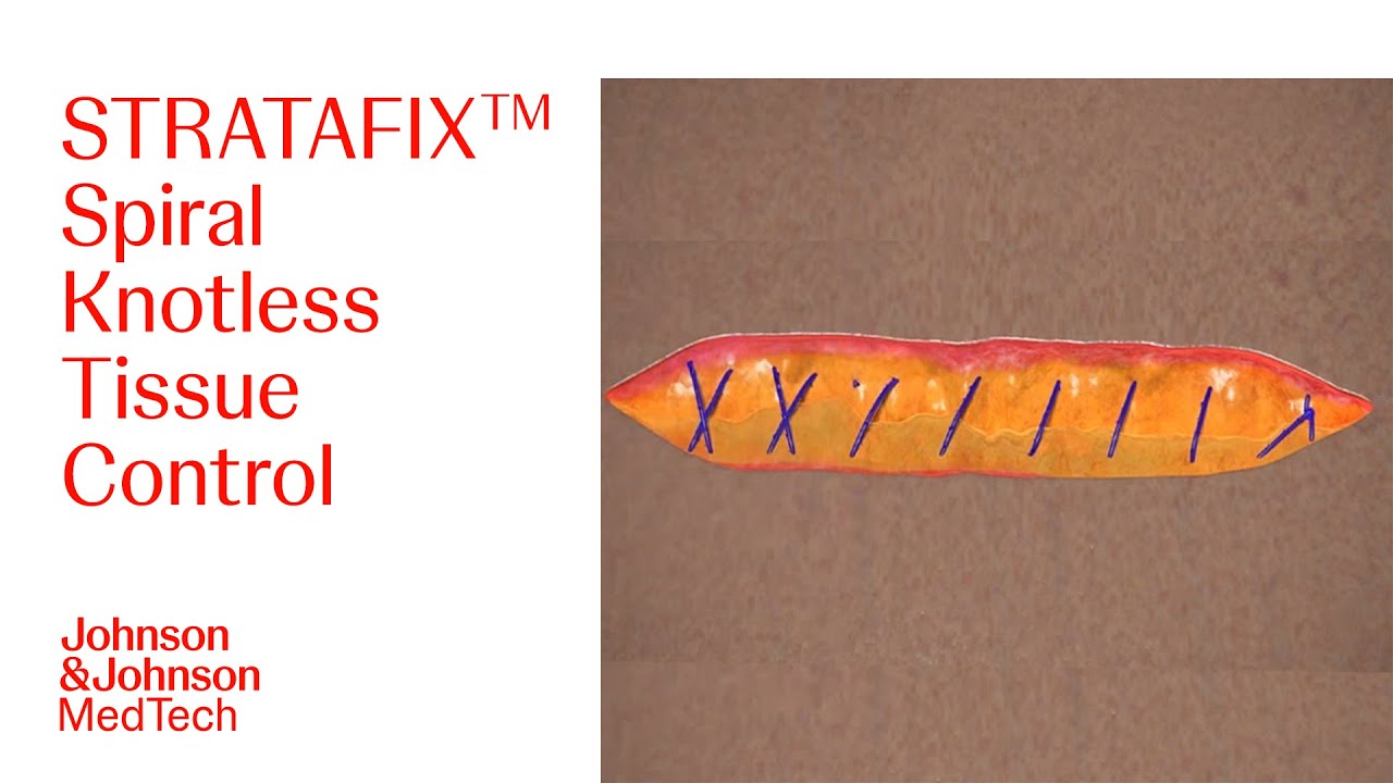 STRATAFIX Spiral Unidirectional Closure Animation | J&J MedTech - YouTube