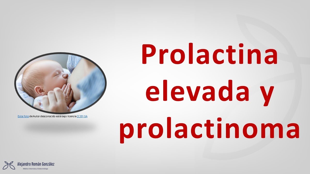 Prolactina elevada y prolactinoma - YouTube
