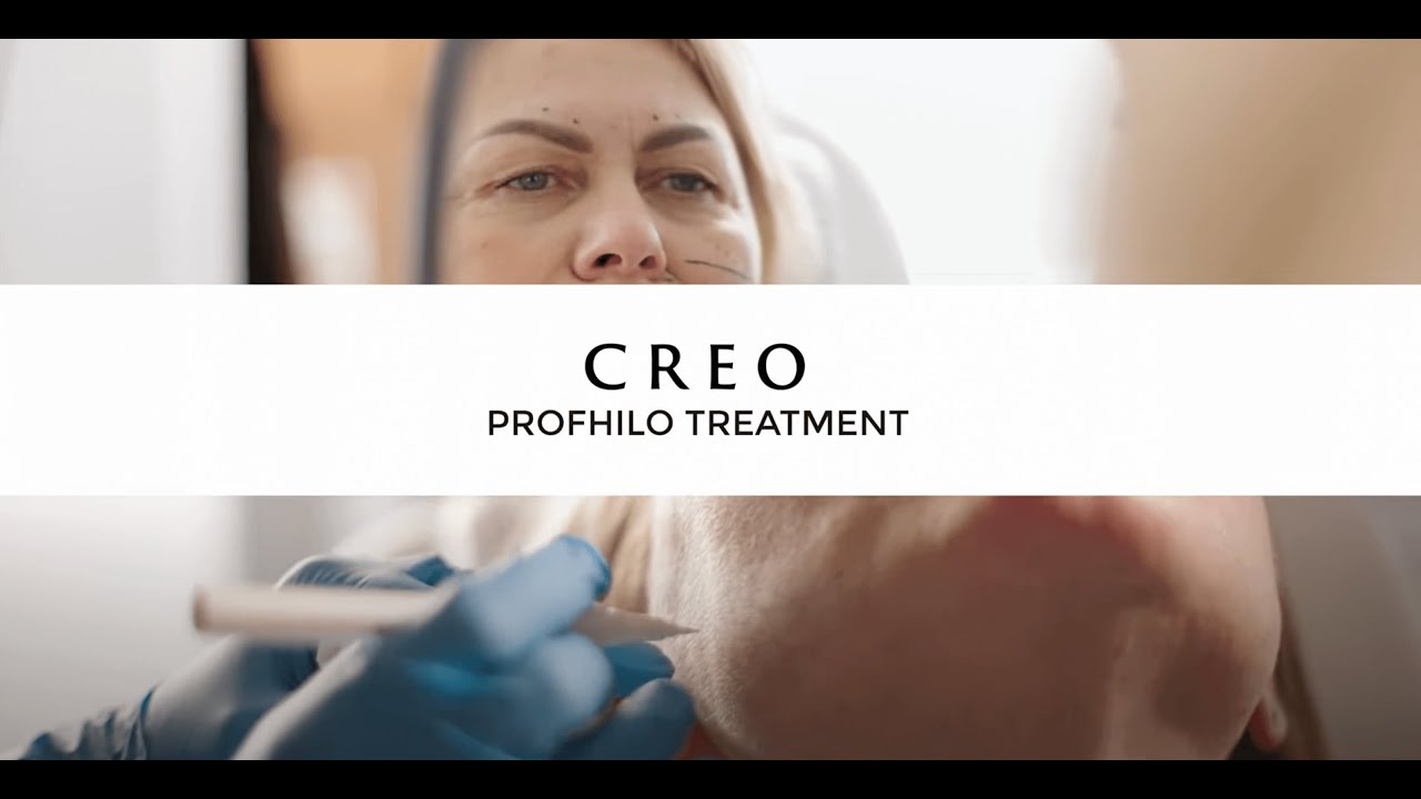 Profhilo Treatment at CREO - YouTube