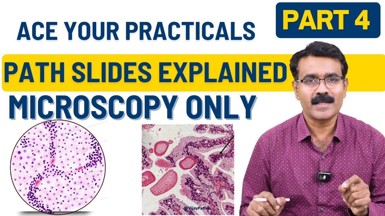 Microscopy Made Easy – Part 4: Quick Revision of Common Pathology ...