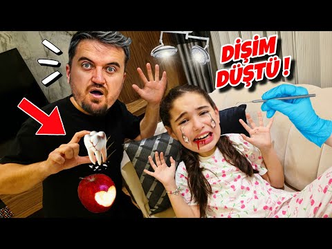 ELİF SİNEMİM DİŞİ DÜŞÜYOR ‼️ EYVAH ELİF KORKTU EVDEN KAÇTI !!