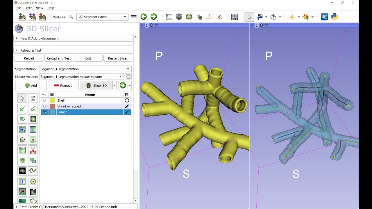 Get vessel centerline from vessel wall model - YouTube