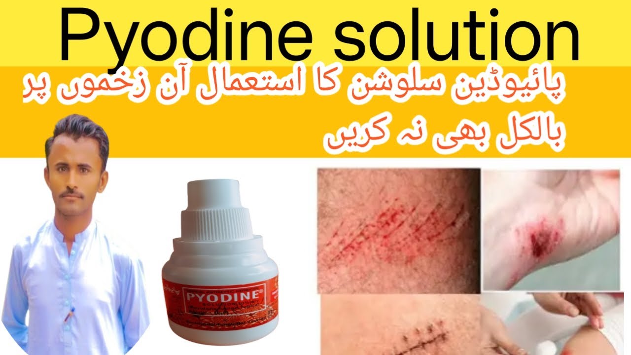 Pyodine solution use|pyodine for wounds |zakham saaf karnayka ka ...