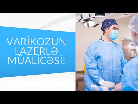 Dr.Mohsum Esgerov varikoz genislenmis damarlari lazerle nece mualice edir!
