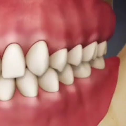 The best way to Brush your teeth | Modified Bass Brushing Technique # ...