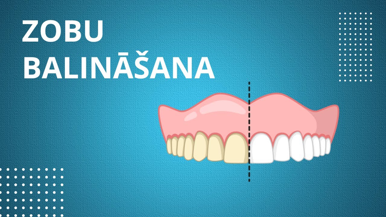 Zobu balināšana - YouTube