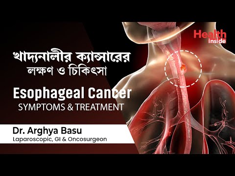 খাদ্যনালীর ক্যান্সারের লক্ষণ ও চিকিৎসা | Esophageal cancer symptoms and treatment in Bengali