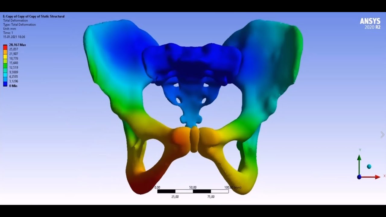 Female Pelvis And Sacrum Analysis - YouTube