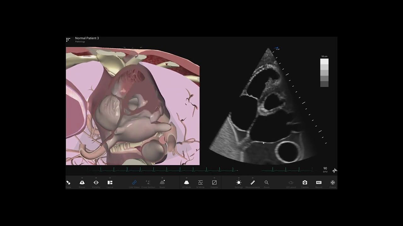 Basic Echocardiography: Using augmented reality to learn cardiac ...