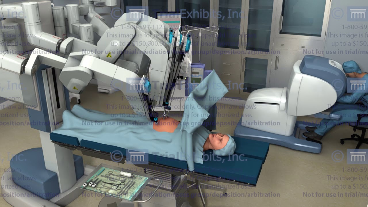 Medical Animations of Robotic Surgery - YouTube