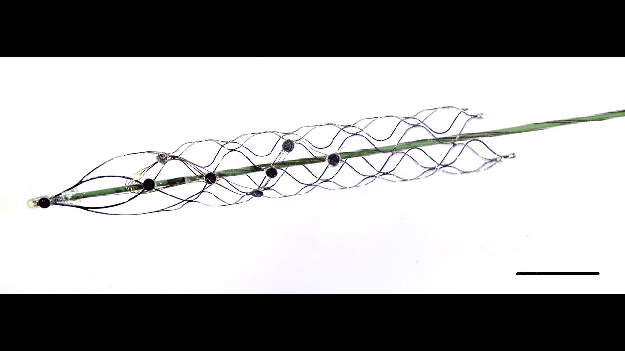 Человеческий мозг впервые подключили к компьютеру через вену без ...