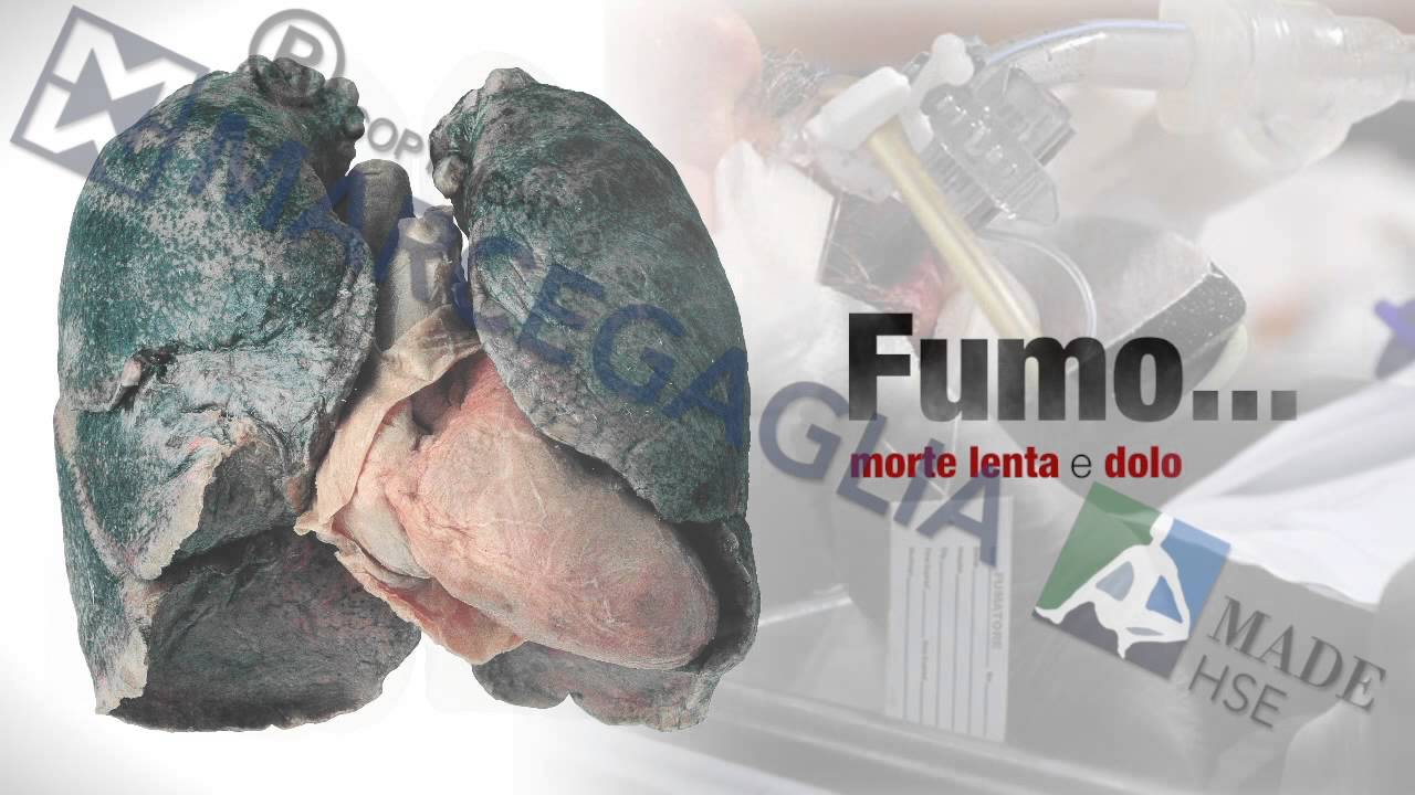 Fumo... morte lenta e dolorosa... - YouTube