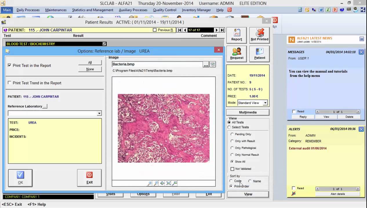 Results Window Options - YouTube