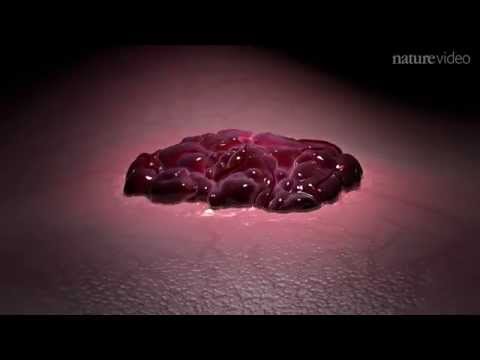 Targeting cancer cell metabolism