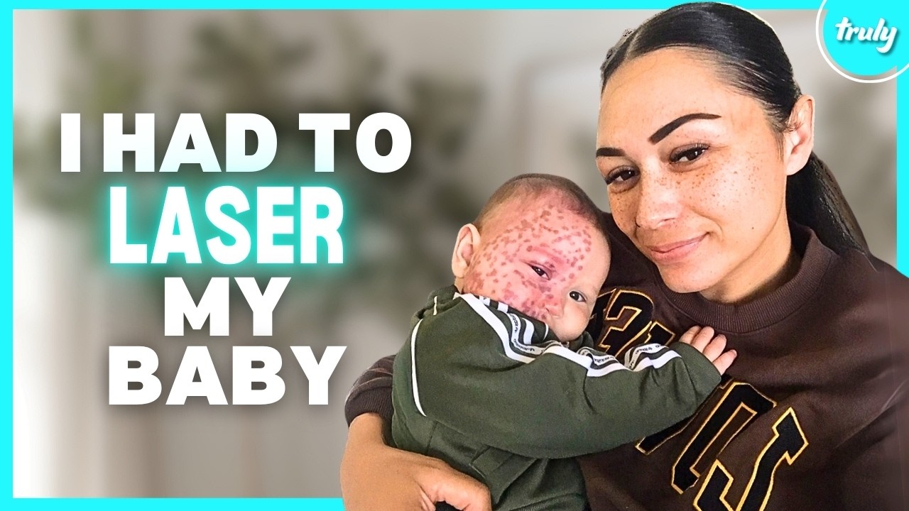 I Had To Laser My Baby At 5 Months Old | BORN DIFFERENT - YouTube