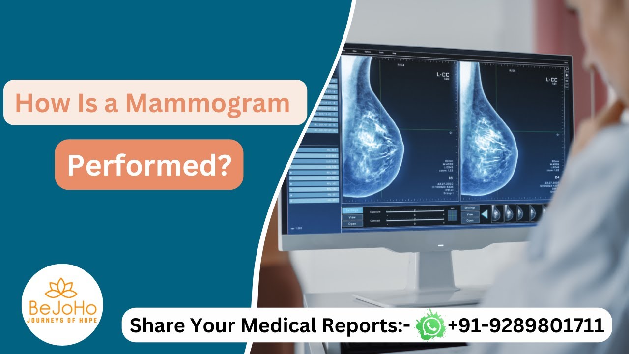 Advised Mammography? Know how a mammography is performed - YouTube