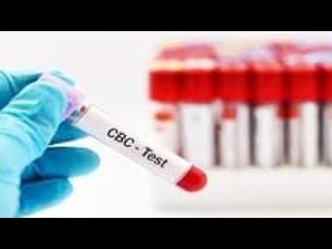 فحص تعداد الدم الكامل (CBC) - YouTube