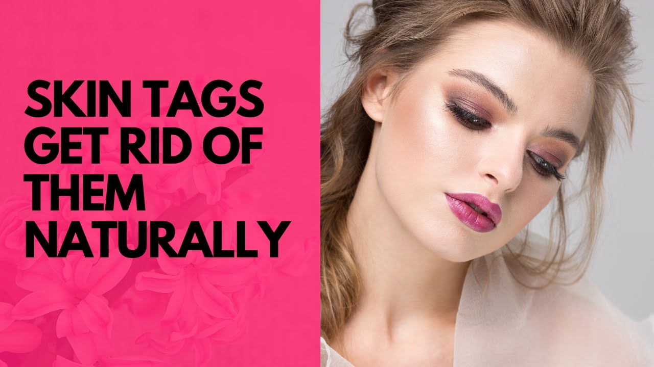 Healing Natural Oils H-Skin Tag Formula Review | Get Rid of Skin Tags ...