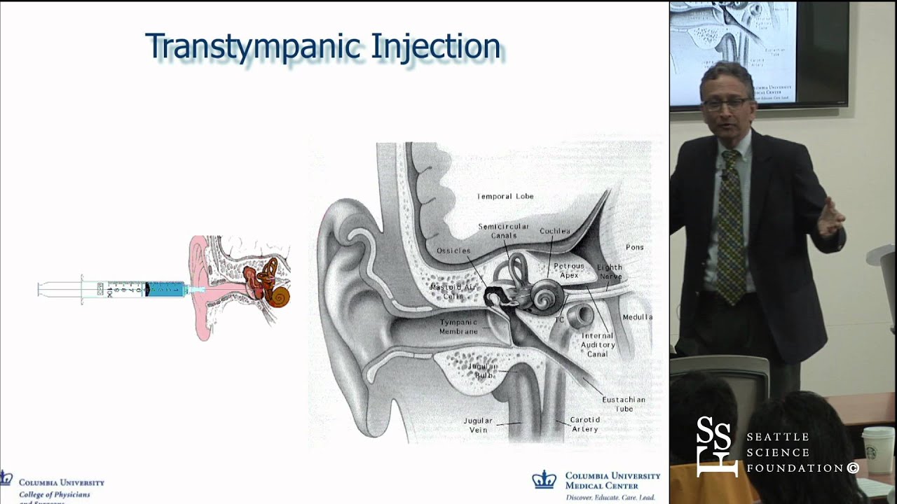 Cochlear Gene Therapy by Anil Lalwani, MD - YouTube