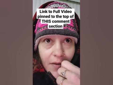 SUPER Rare Medical Condition CRAZY Update - YouTube