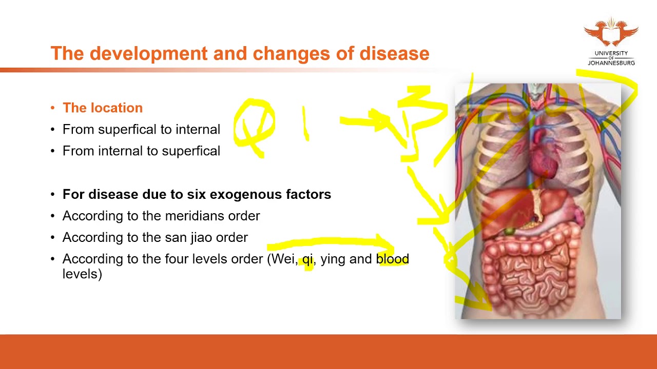159. UJ online lectures:Basic theory 51 Pathogenesis 7 Development Of ...