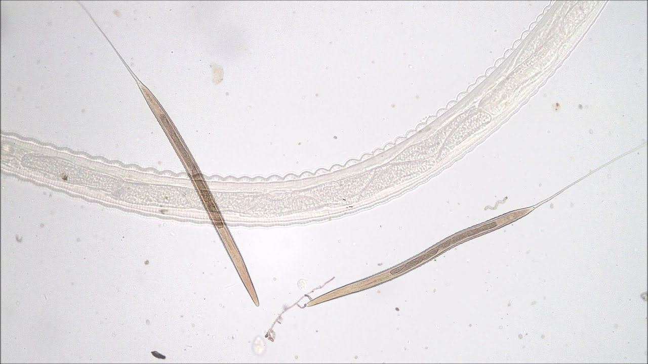 Equine cyathostomes vs free living larva - YouTube