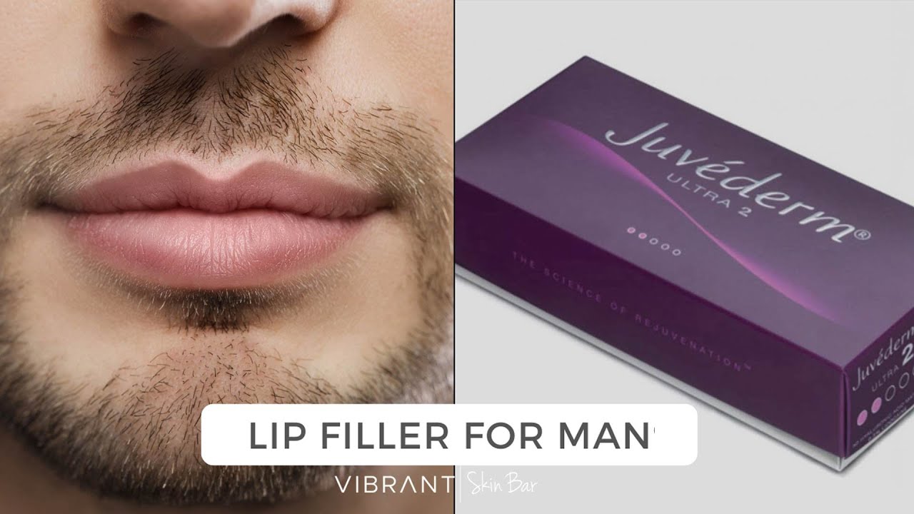 Lip Fillers: Lip Injections for Men - YouTube
