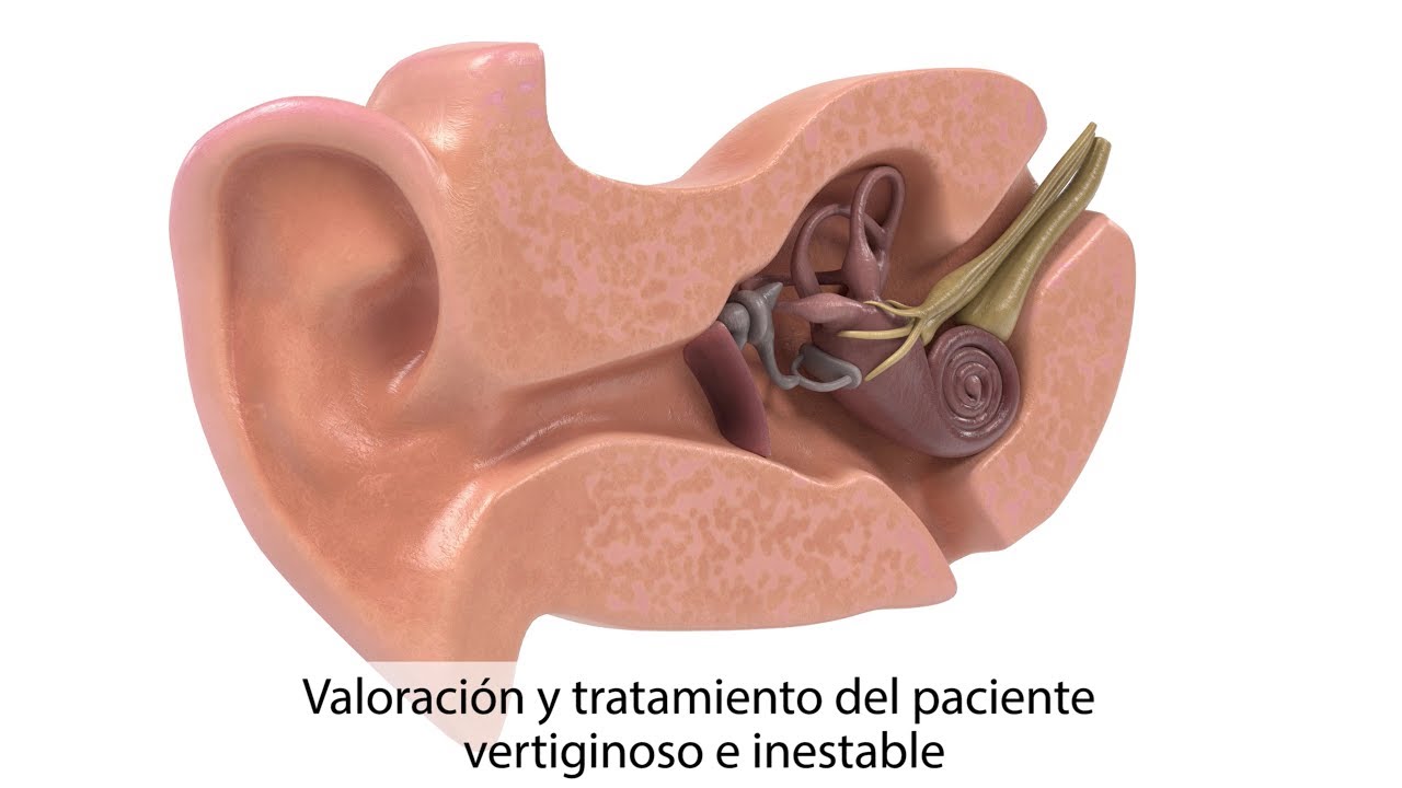 Valoración y tratamiento del paciente vertiginoso e inestable ...
